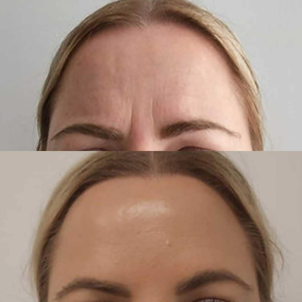 Cosmetic Injectables & Appearance Medicine, Sass Skin Pukekohe